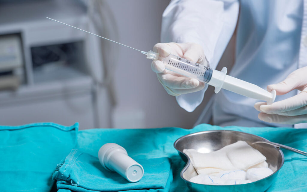 What is amniocentesis? - NIPT by GenePlanet